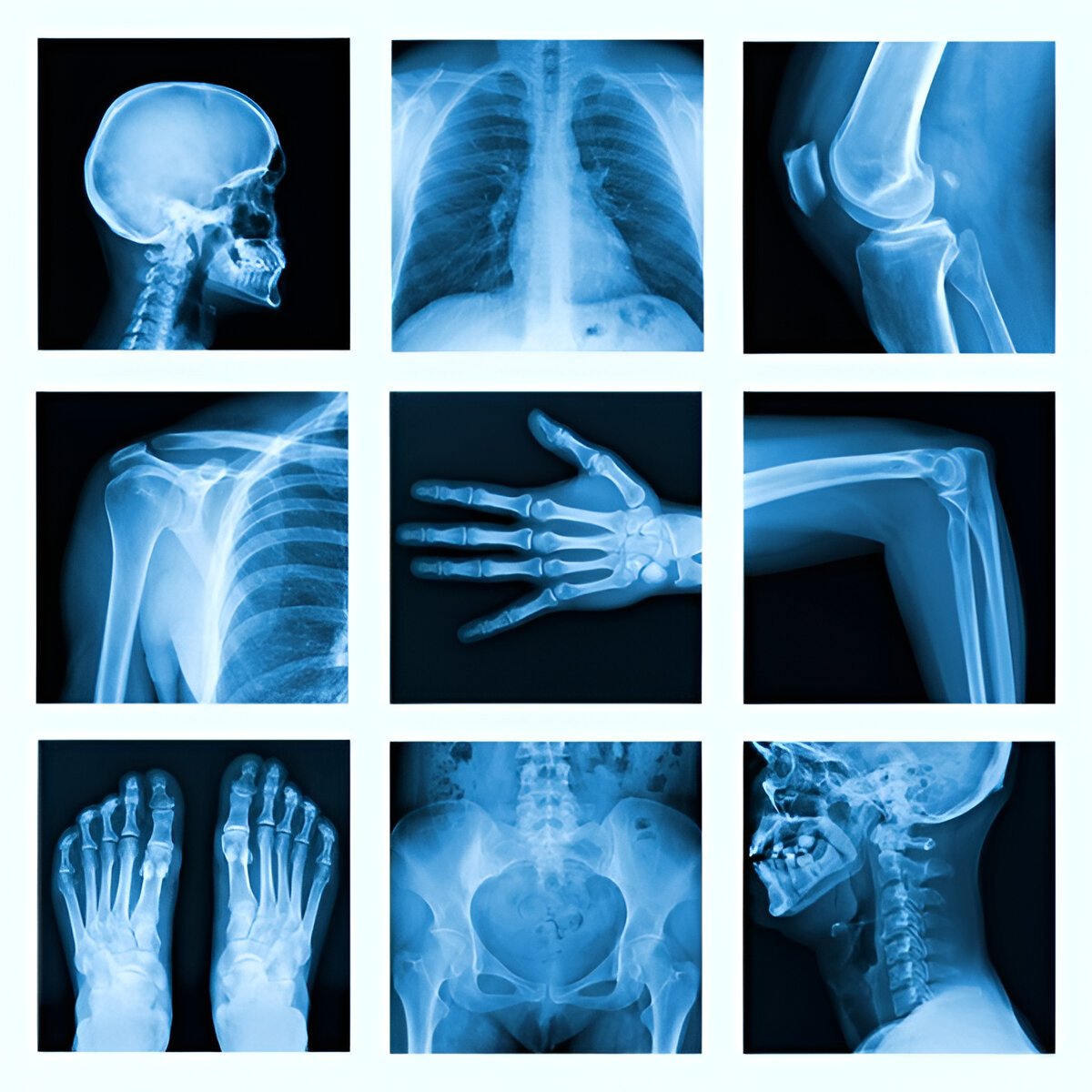 Fractures & Trauma Care in Hyderabad | Secunderabad